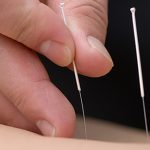 Tiny Needles, Big Relief: 4 Conditions Acupuncture Can Help - MedShadow