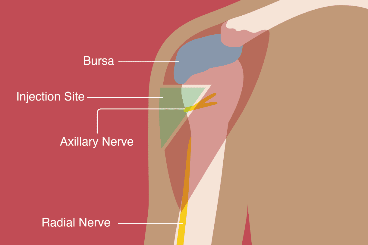 Shoulder Archives - MedShadow Foundation | Independent Health ...