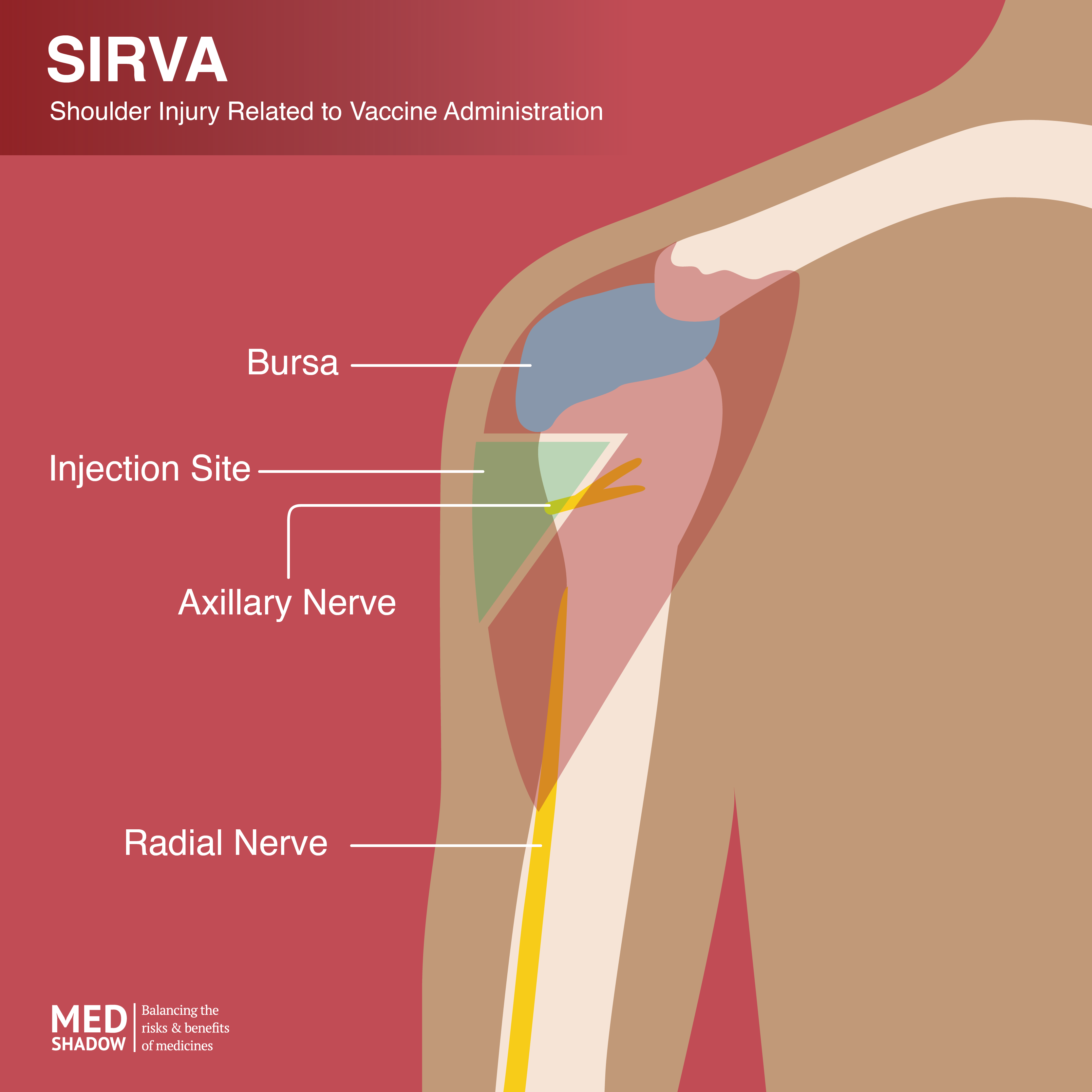 Shoulder Pain After Vaccination When Do I Need To See A Doctor