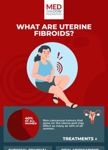 Fibroids Infographic - MedShadow Foundation | Independent Health ...
